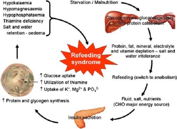Thiamine Repletion, Calcium Management, and the Heart - Hormones Matter